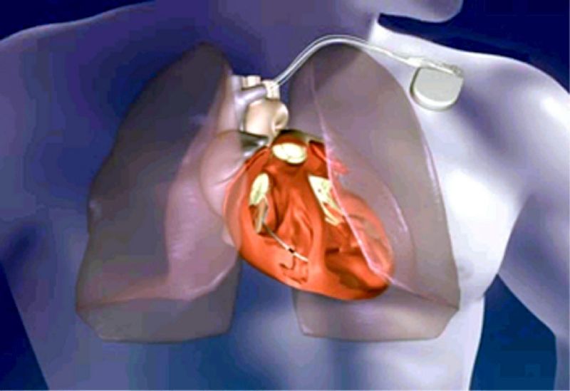 ¿Por qué no hay casos de cáncer de corazón?