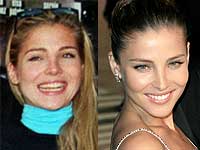 Famosos que transformaron su cara